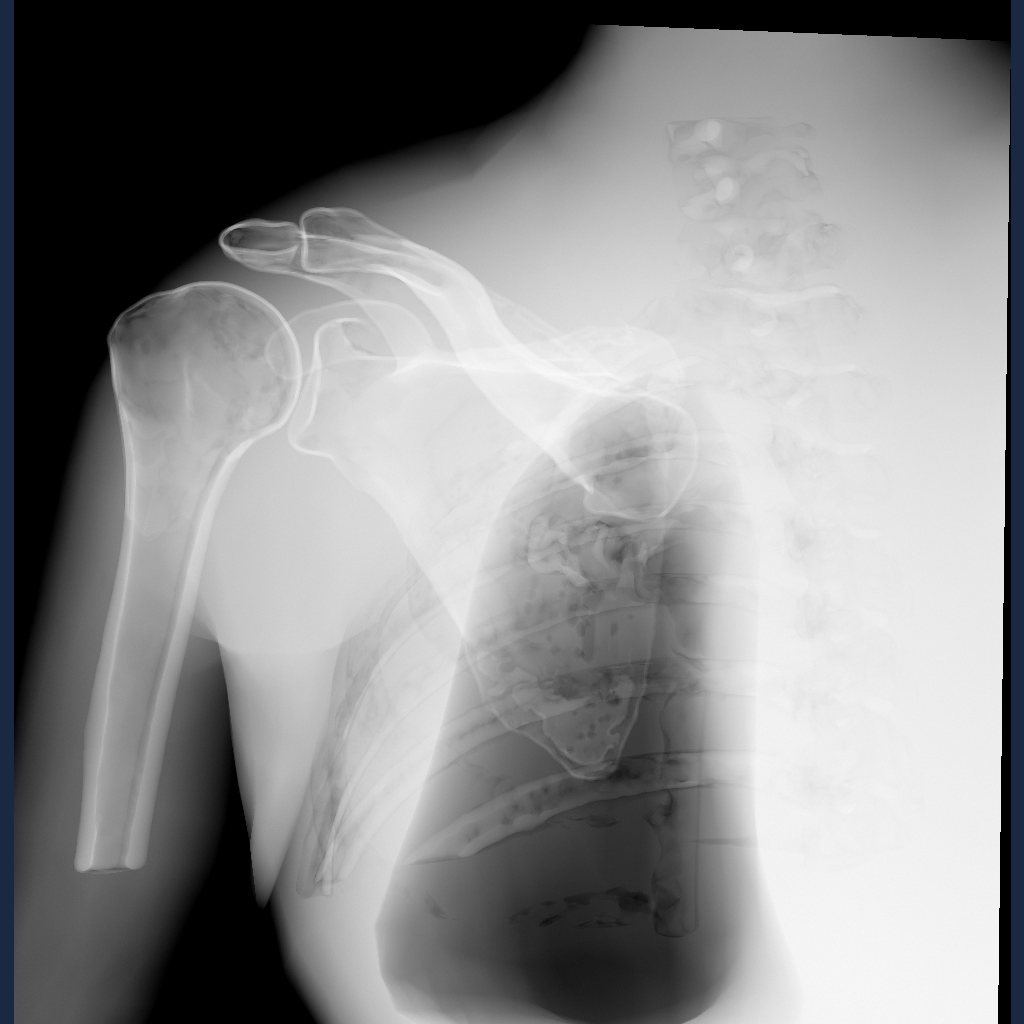 Shoulder – VitaSim